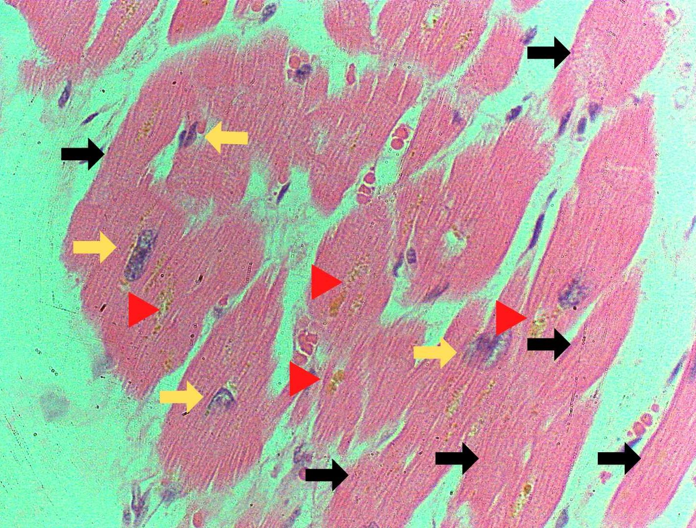 DISTÚRBIOS CIRCULATÓRIOS :: Atlas Virtual de Patologia
