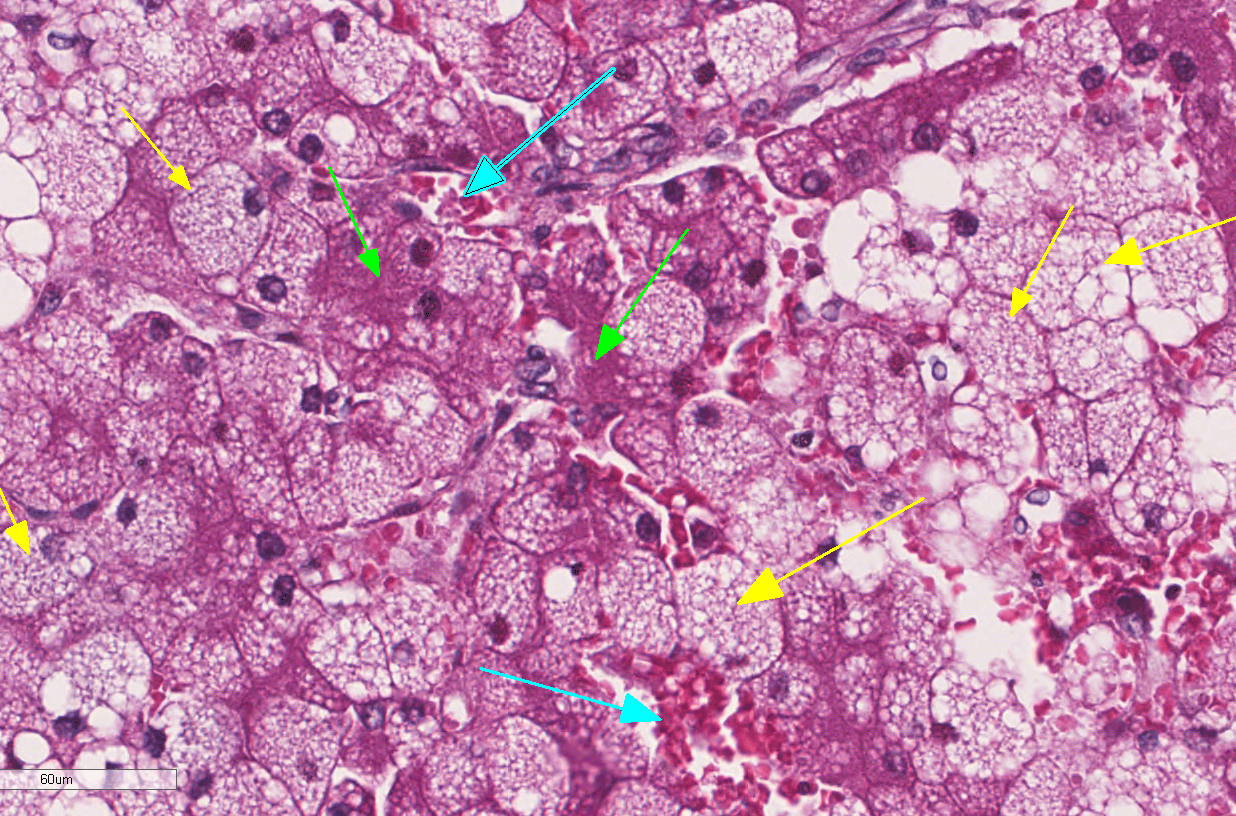 LESÕES CELULARES :: Atlas Virtual de Patologia